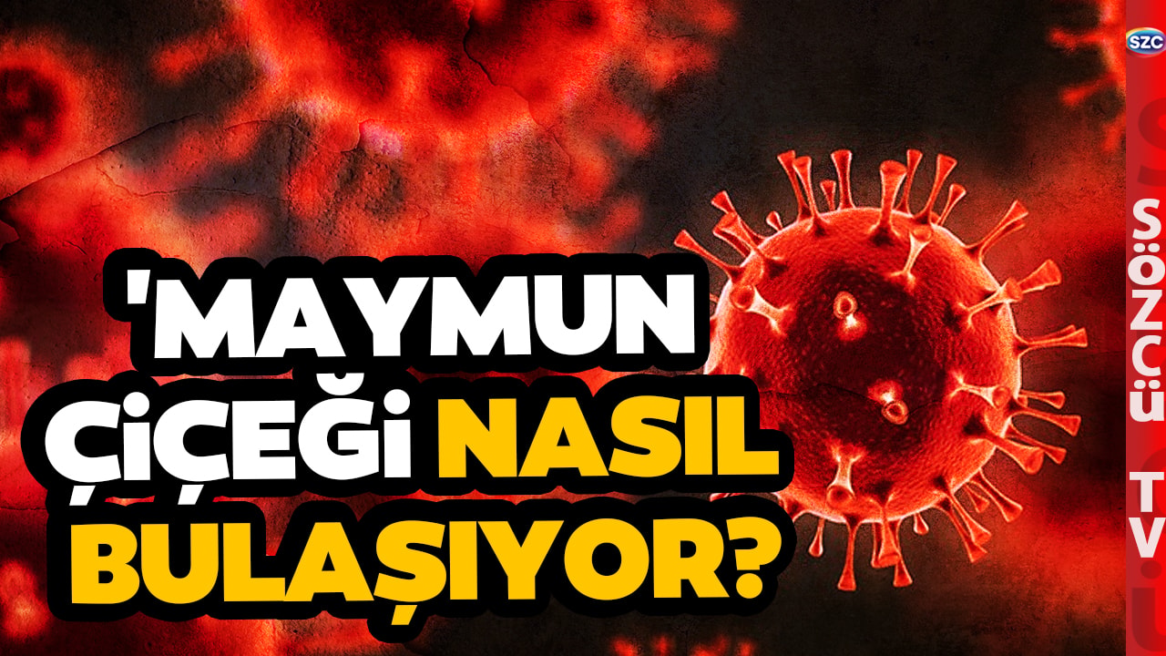 Maymun Çiçeği Virüsü Yayılıyor! Uzman İsim Virüse Karşı Yapılması ...